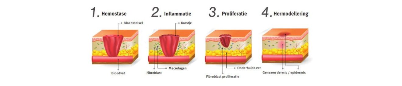 Hoe voorkom je littekens? – Happy Healthcare